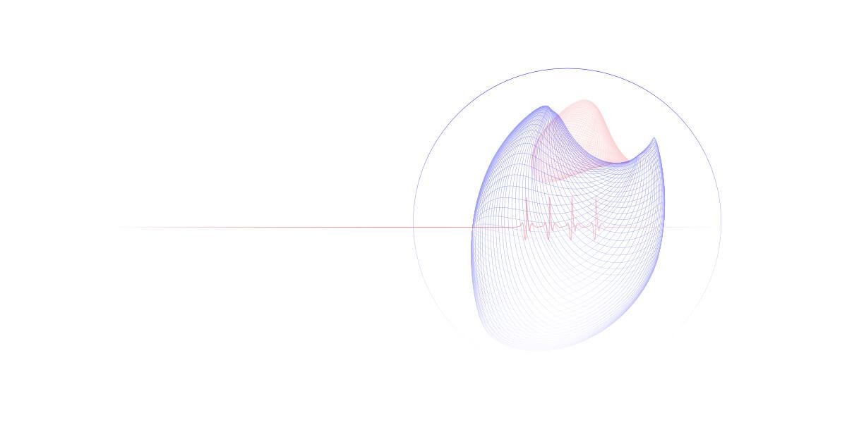 ERAS® - Enhanced Recovery After Cardiac Surgery Society